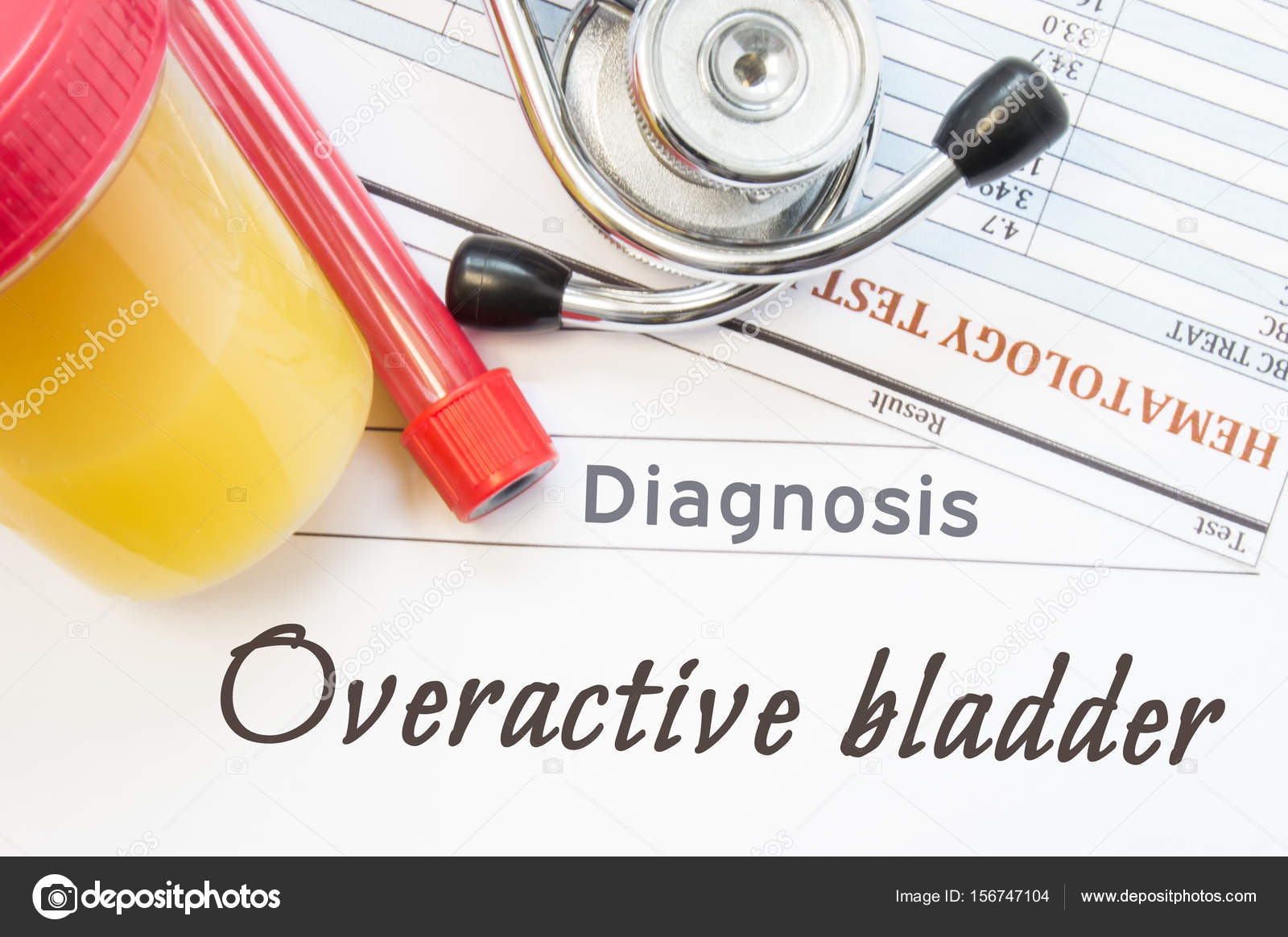 Overactive Bladder diagnosis. Container with urine sample, tube with ...
