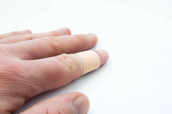 Wounded back of the wrist (cut, burn) and the wound is covered with ...