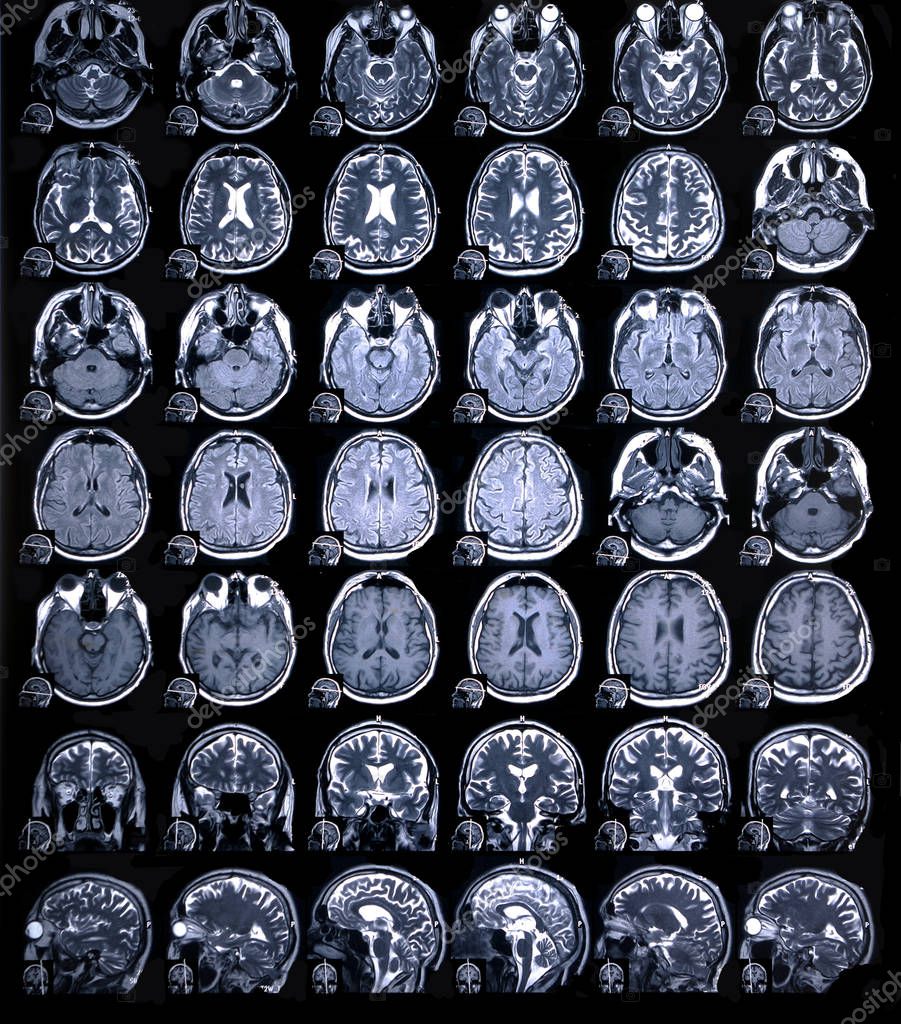 Exploración por resonancia magnética o resonancia magnética de la ...