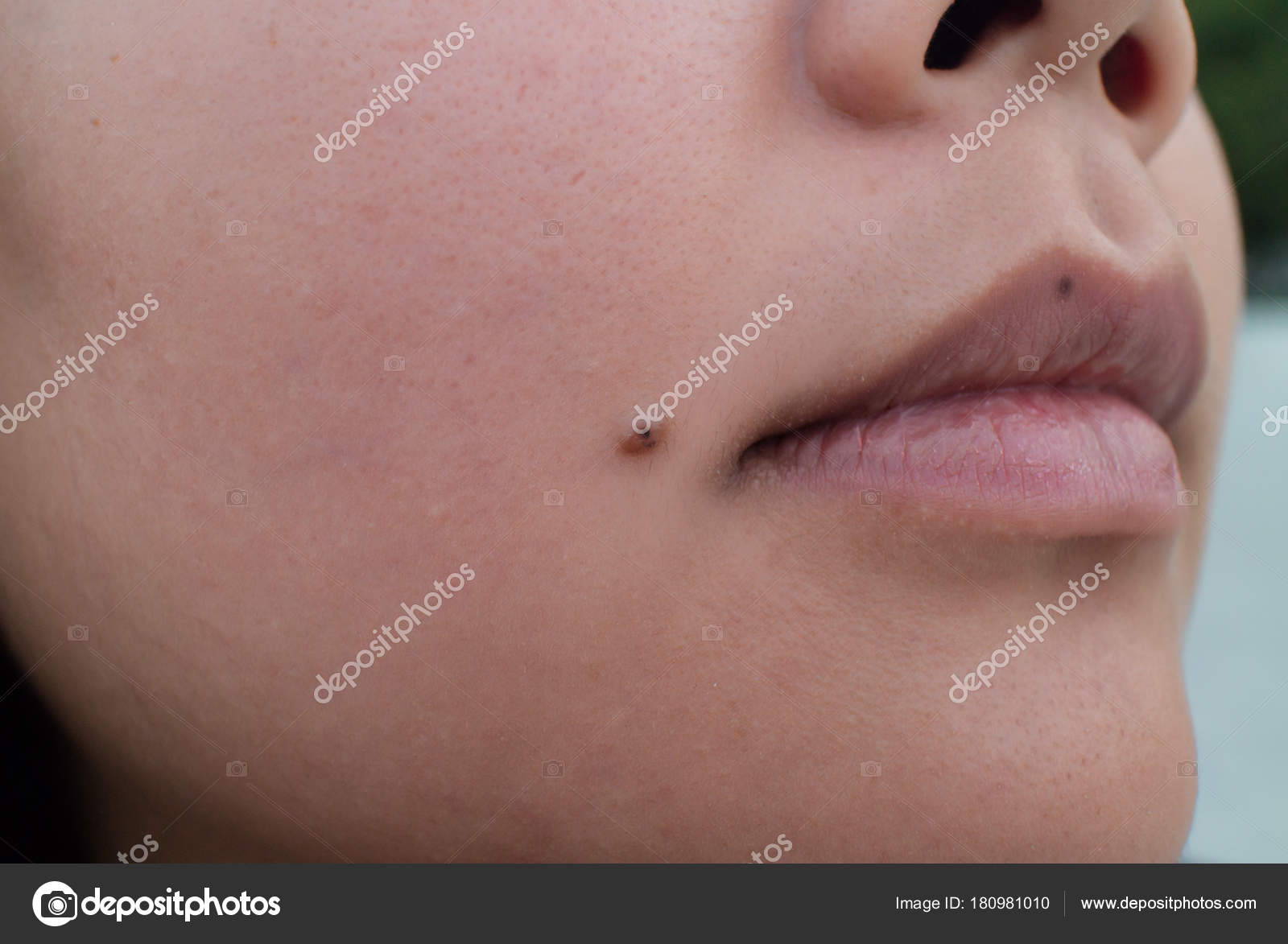 Mole Asian Girl's Face Stock Photo by ©catinsyrup 180981010