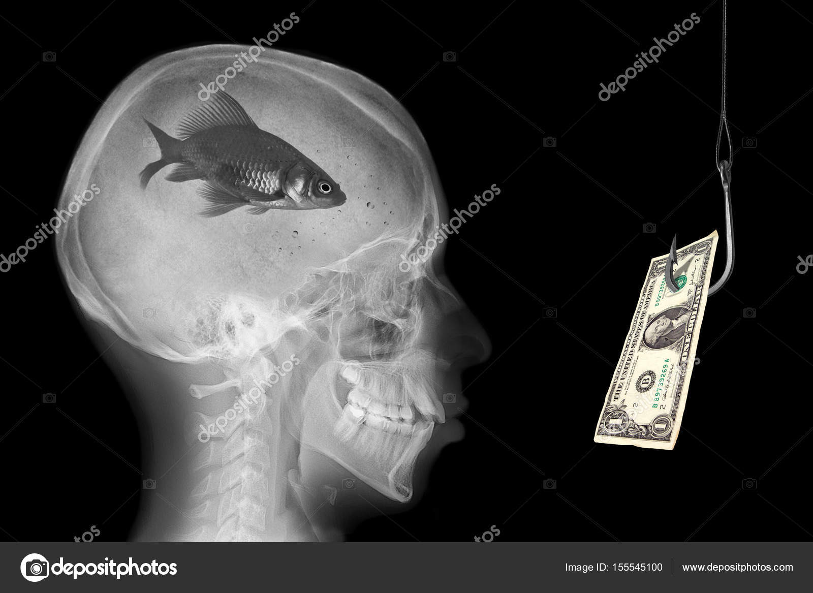 Radiography of skull with fish in the brain Stock Photo by ©teotarras ...