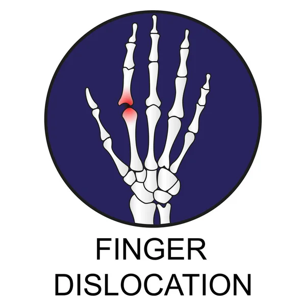 Dislocation Vector Art Stock Images | Depositphotos