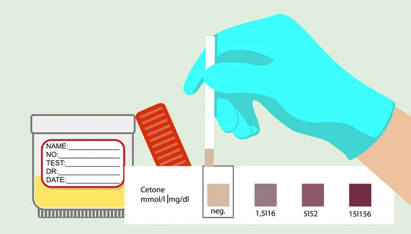 Medical urine analysis Stock Photos, Royalty Free Medical urine ...