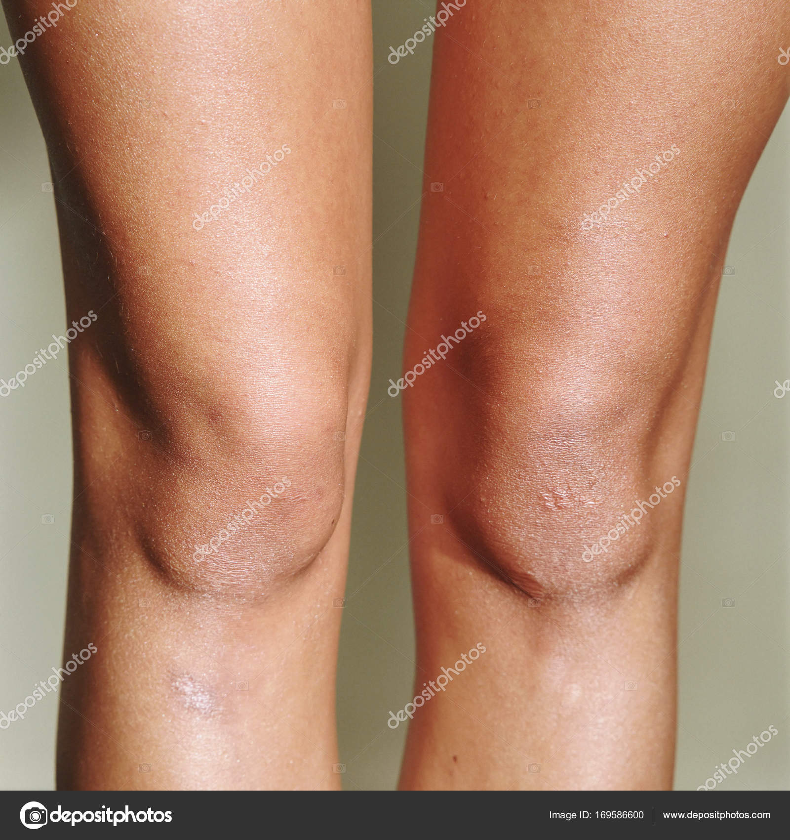 Close View Female Knees Isolated Color Background — Stock Photo ...