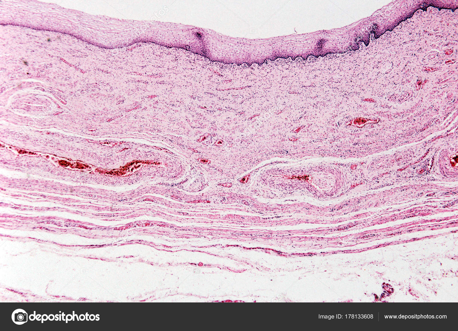 High Magnification Microscopic View Vagina — Stock Photo © ImageSource ...