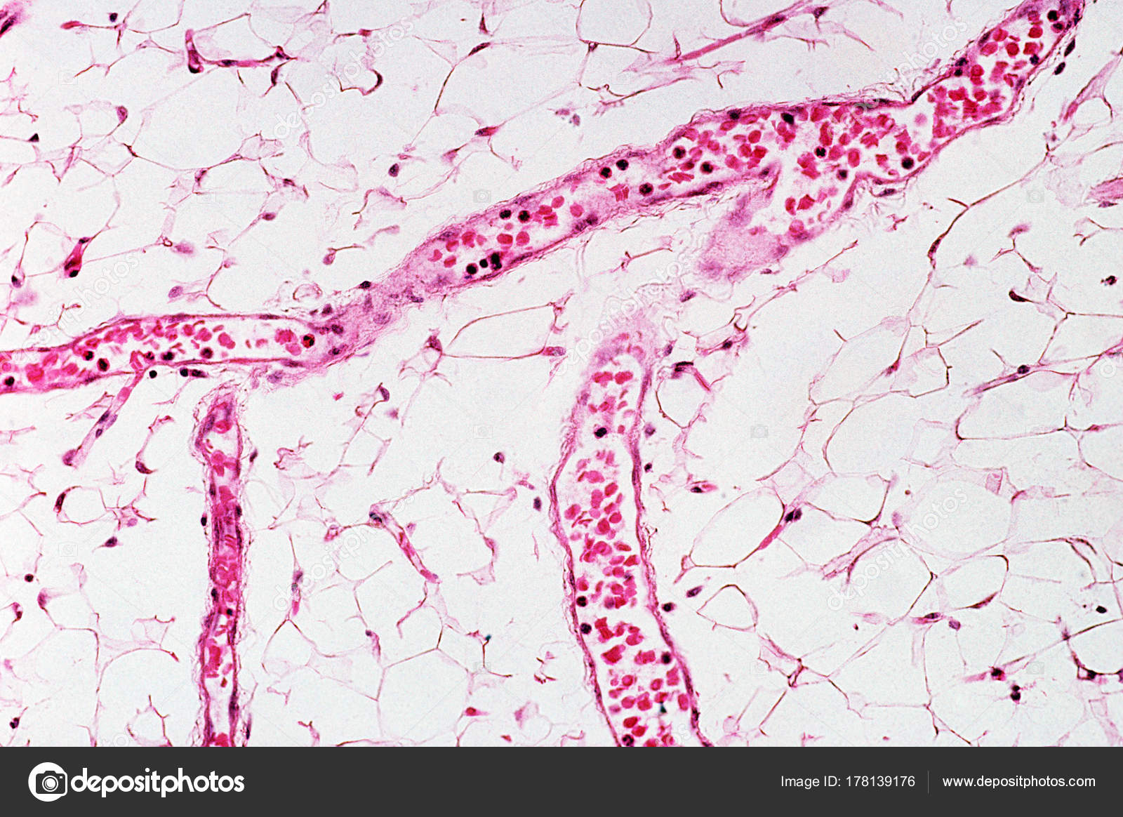 High Magnification Microscopic View Capilliaries — Stock Photo ...
