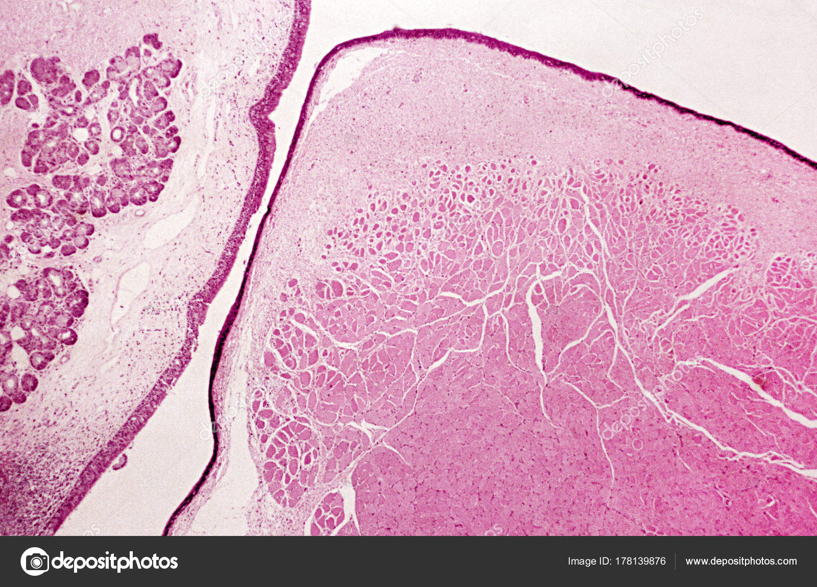 High Magnification Microscopic View Larynx Stock Photo by ©ImageSource ...