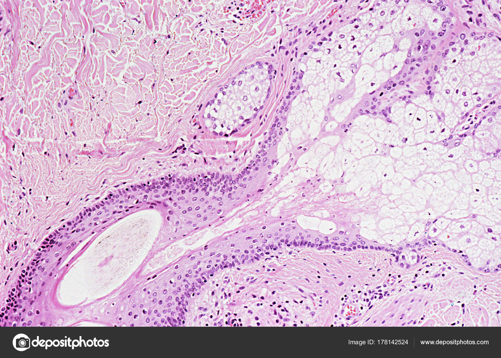 High Magnification Microscopic View Skin Cells Stock Illustration by ...
