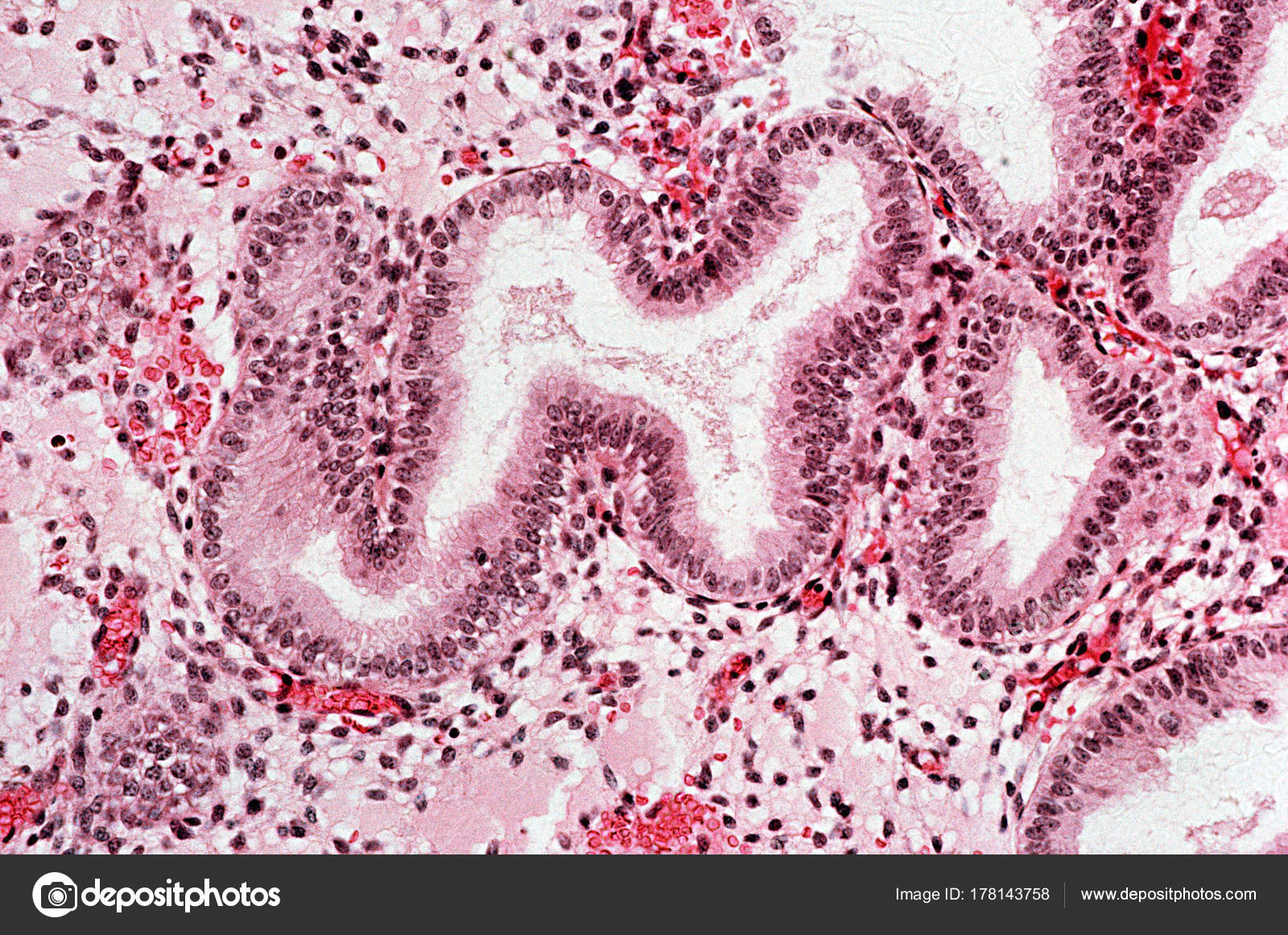 High Magnification Microscopic View Endometrium Stock Photo by ...
