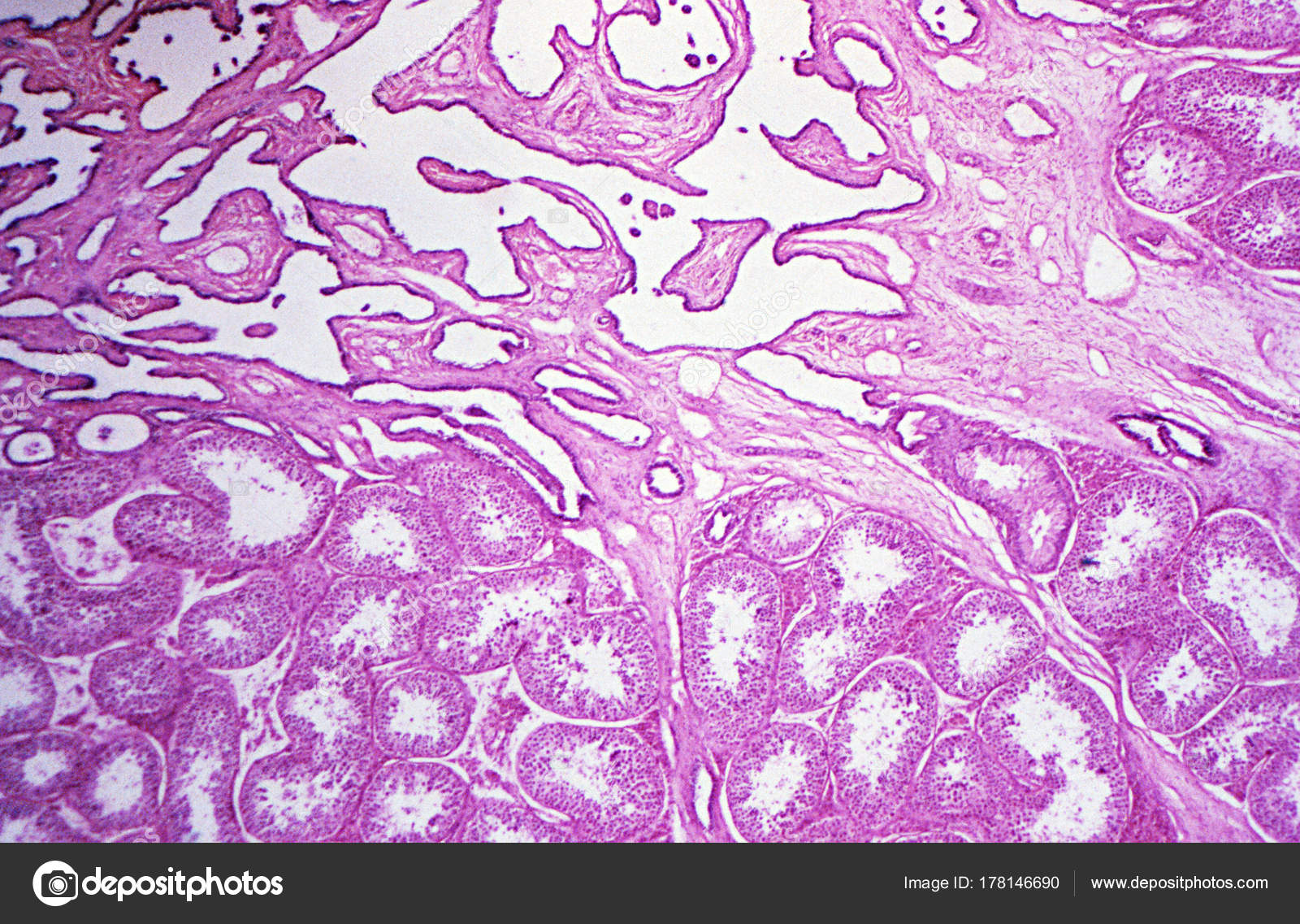 High Magnification Microscopic View Testis — Stock Photo © ImageSource ...