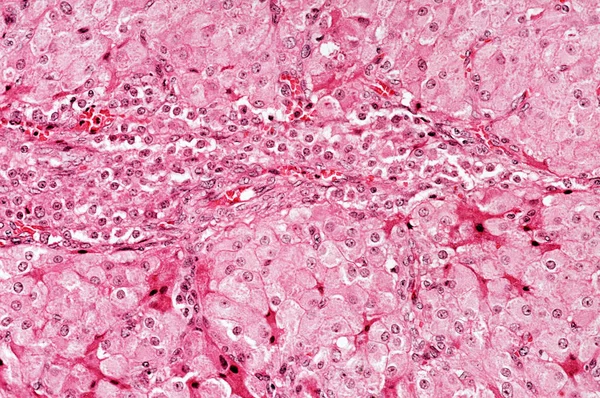 High Magnification Microscopic View Pancreas Stock Photo by ...