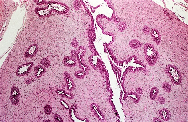 High Magnification Microscopic View Pancreas Stock Photo by ...