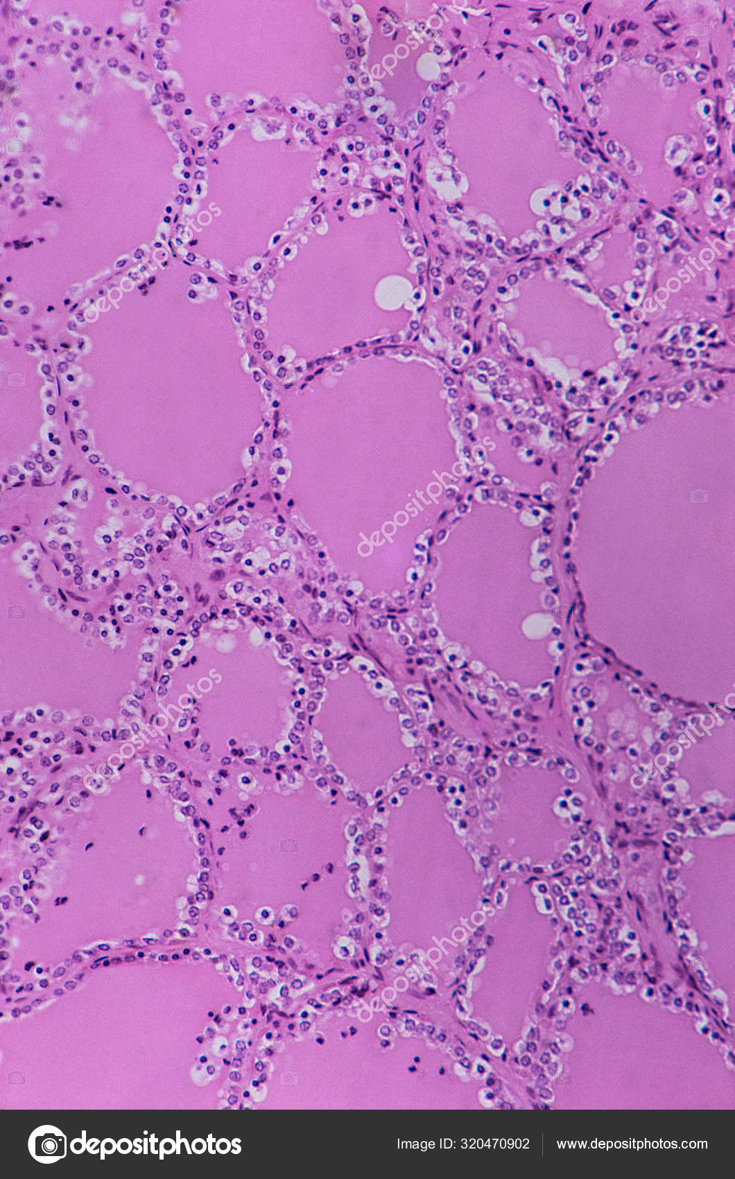 Follicles Colloid Thyroid — Stock Photo © ImageSource #320470902