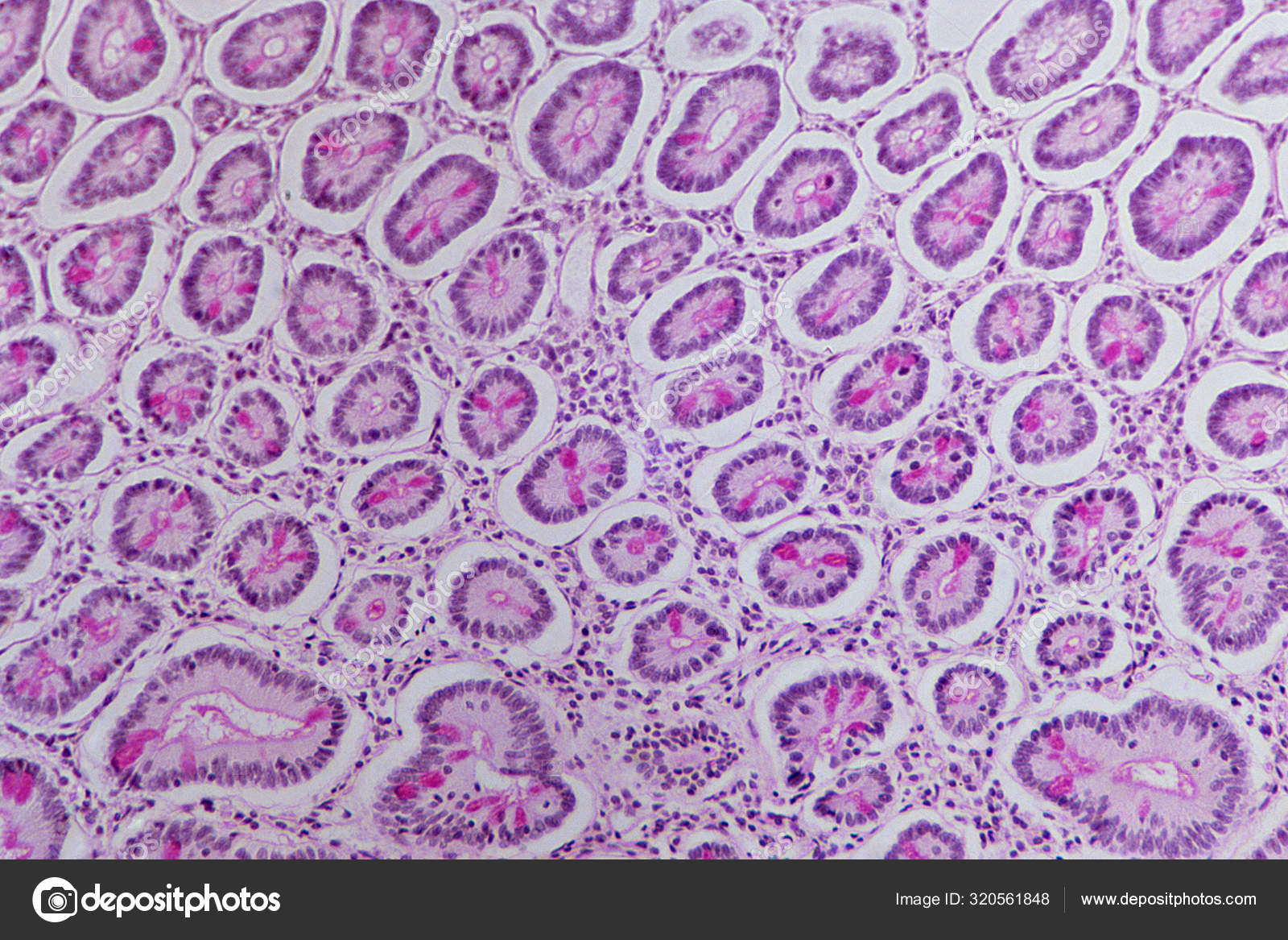 Goblet Cells In Stomach