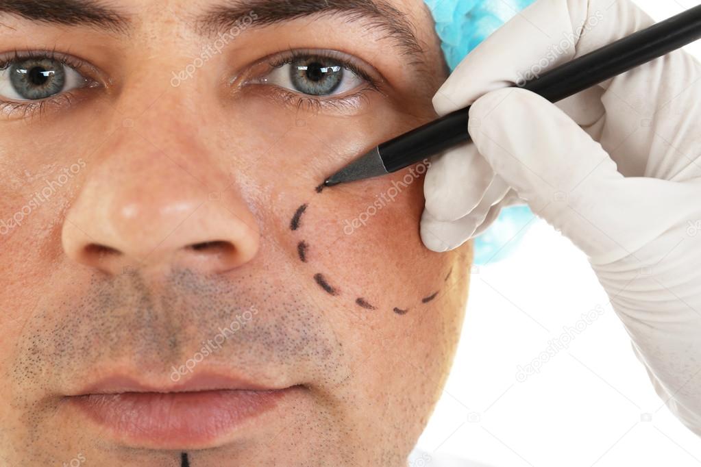 Plastic surgery concept. Hand in glove marking male face — Stock Photo ...
