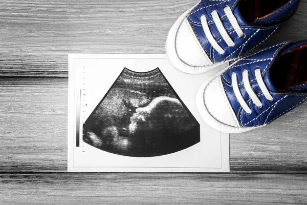 Ultrasound baby scan Stock Photo by ©belchonock 135621292