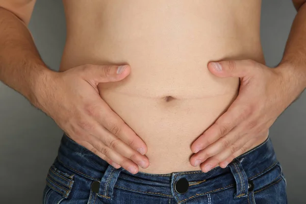 Fettbauch Stock Photos, Royalty Free Fettbauch Images | Depositphotos