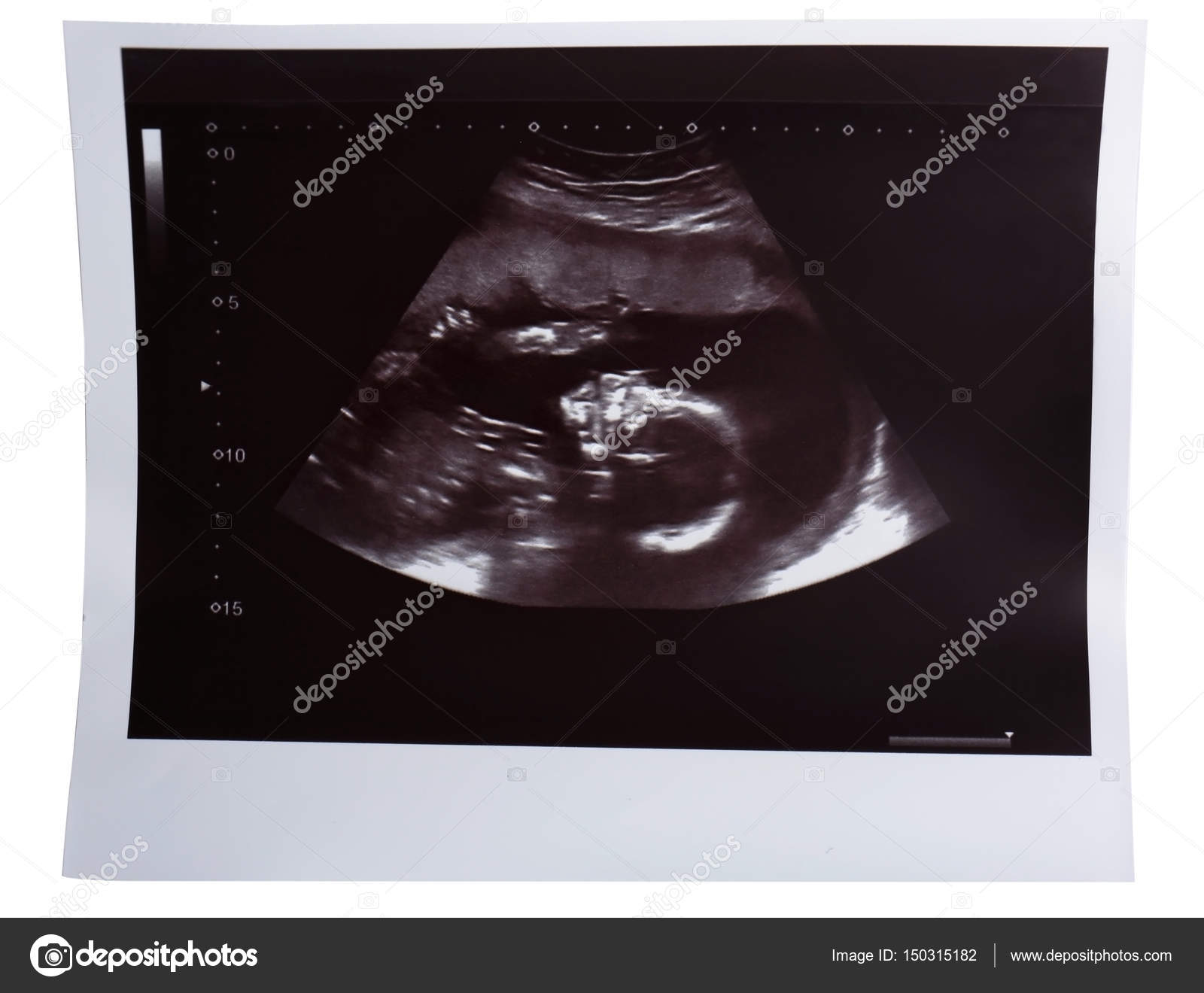 Ultrasound baby scan — Stock Photo © belchonock #150315182