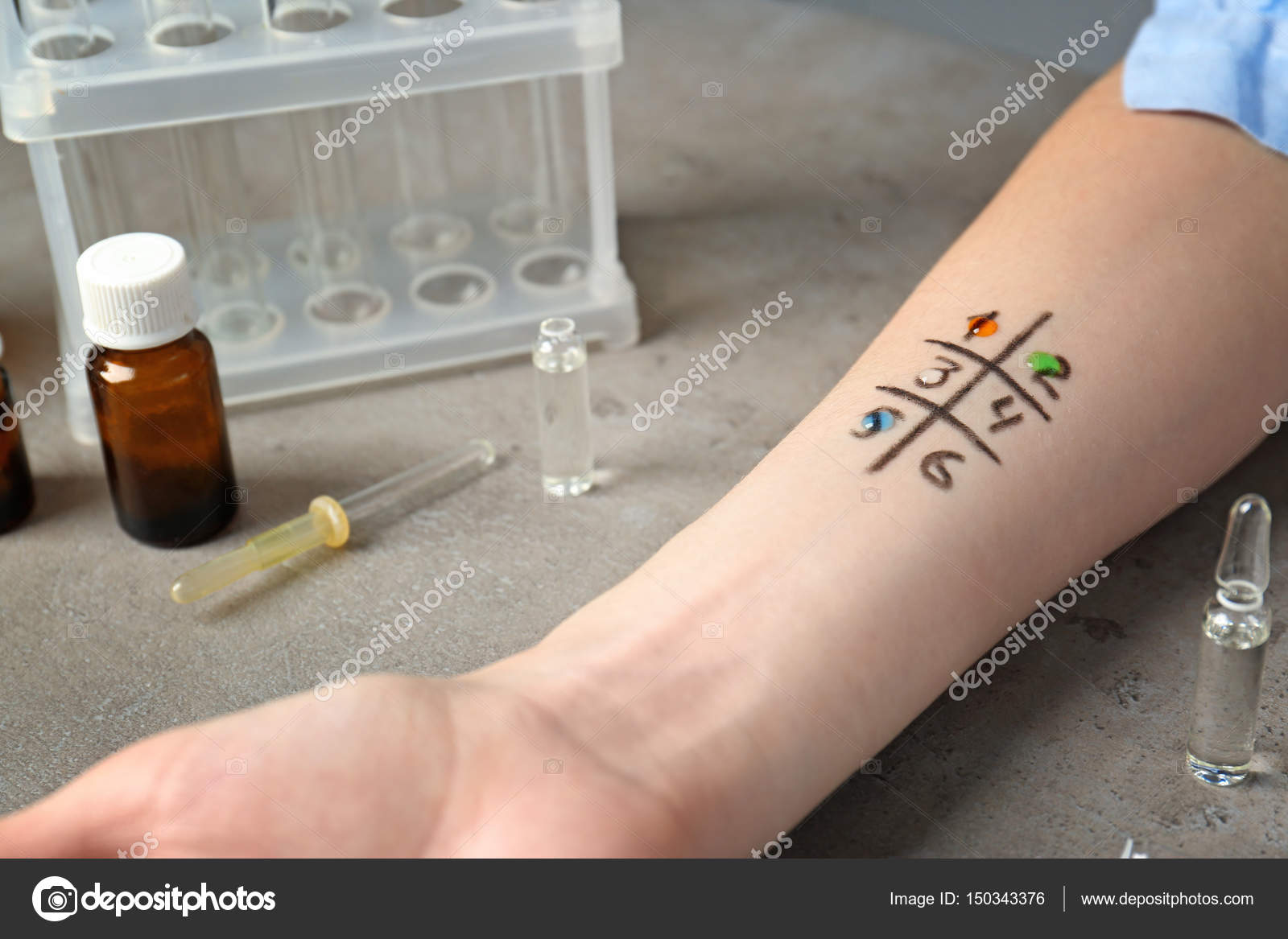 Patient making allergy test — Stock Photo © belchonock #150343376