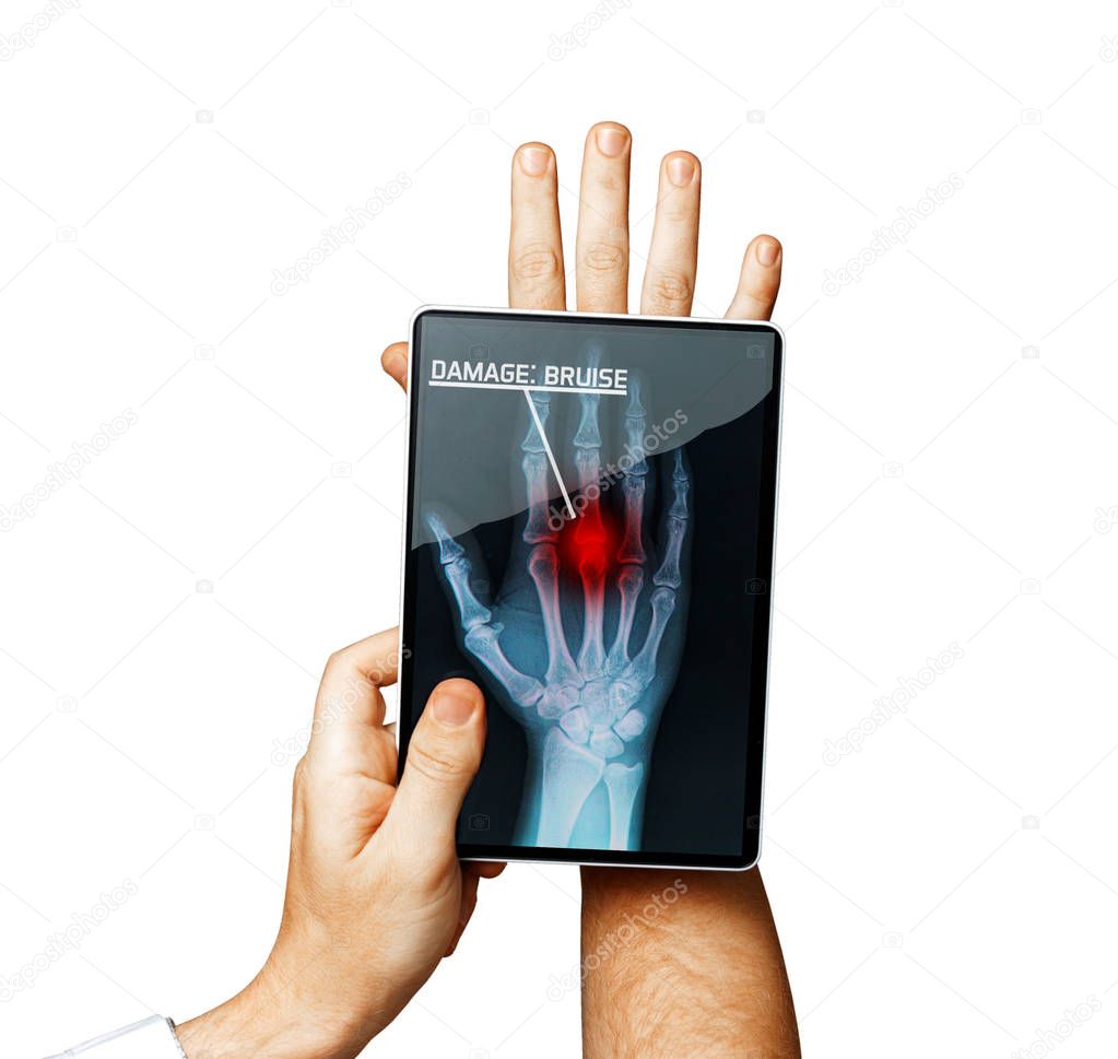 El doctor con la tableta digital escanea la mano del paciente ...