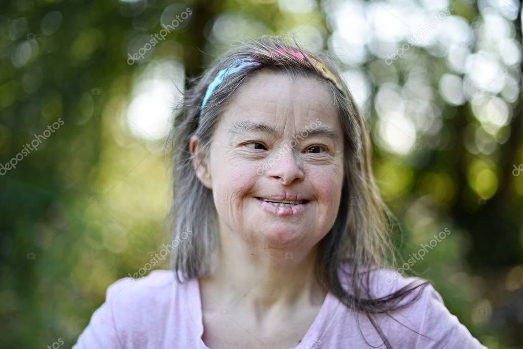 Woman with down syndrome — Stock Photo © muro #131317262