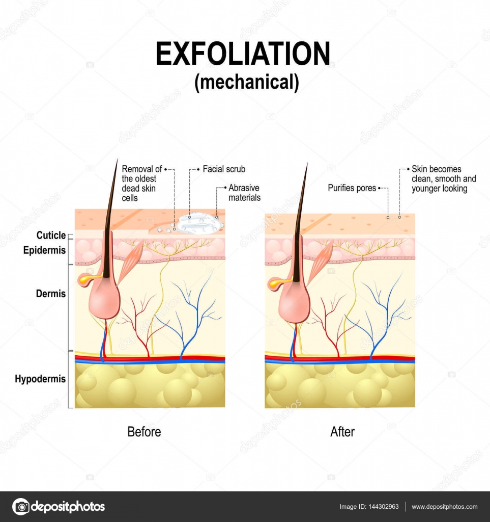 Exfoliation Diagram