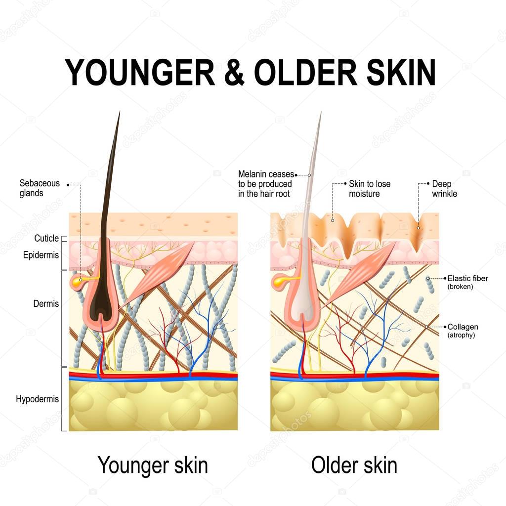 Human skin changes or ageing skin. — Stock Vector © edesignua #144303189