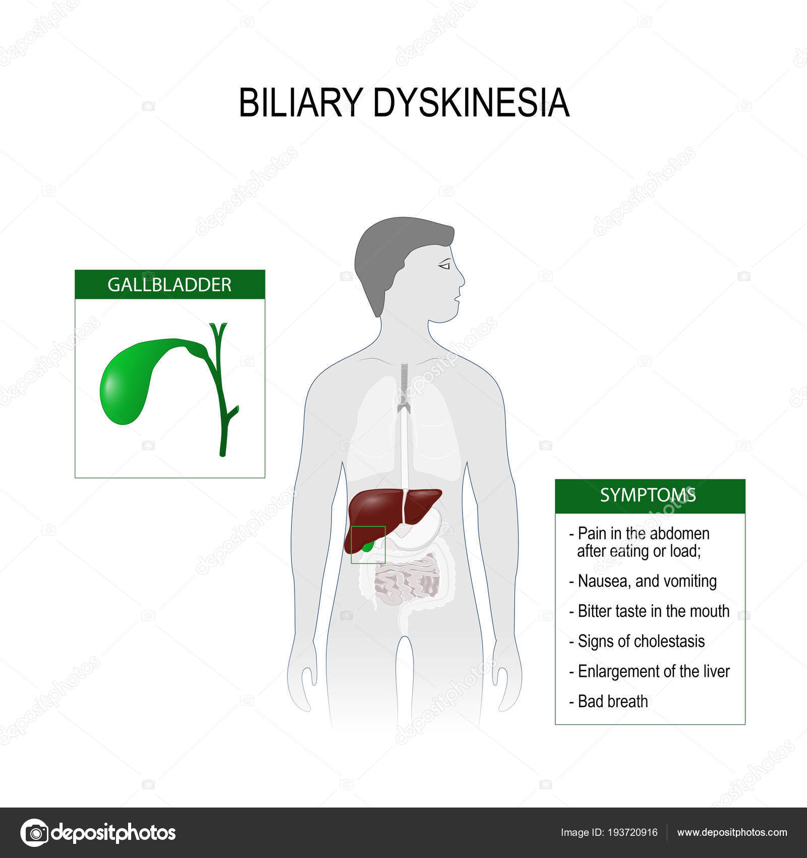 Biliary Dyskinesia Symptoms Biliary Dyskinesia Symptoms