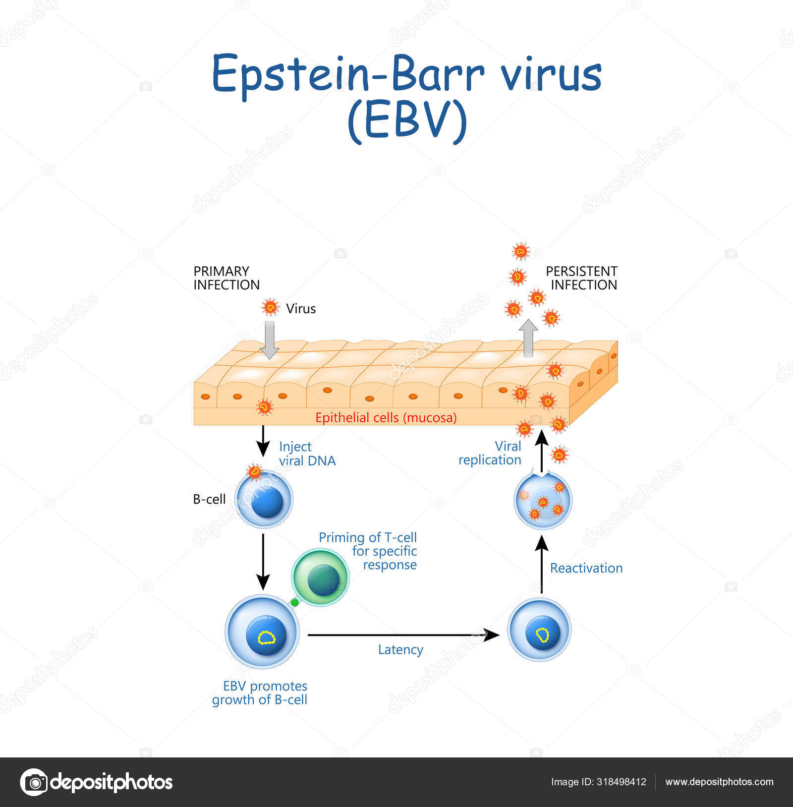 Herpes. The Epstein-Barr virus (EBV) replication cycle Stock Vector ...