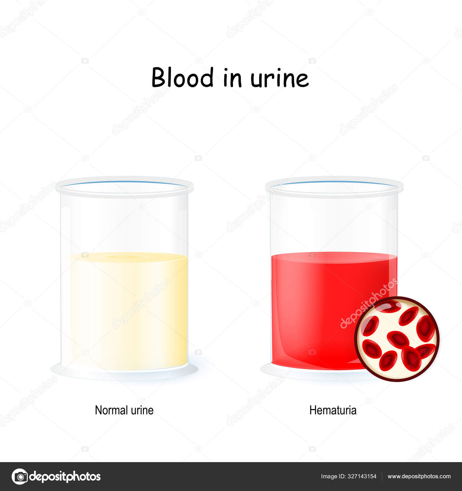 Normal Makeup Of Urine | Saubhaya Makeup