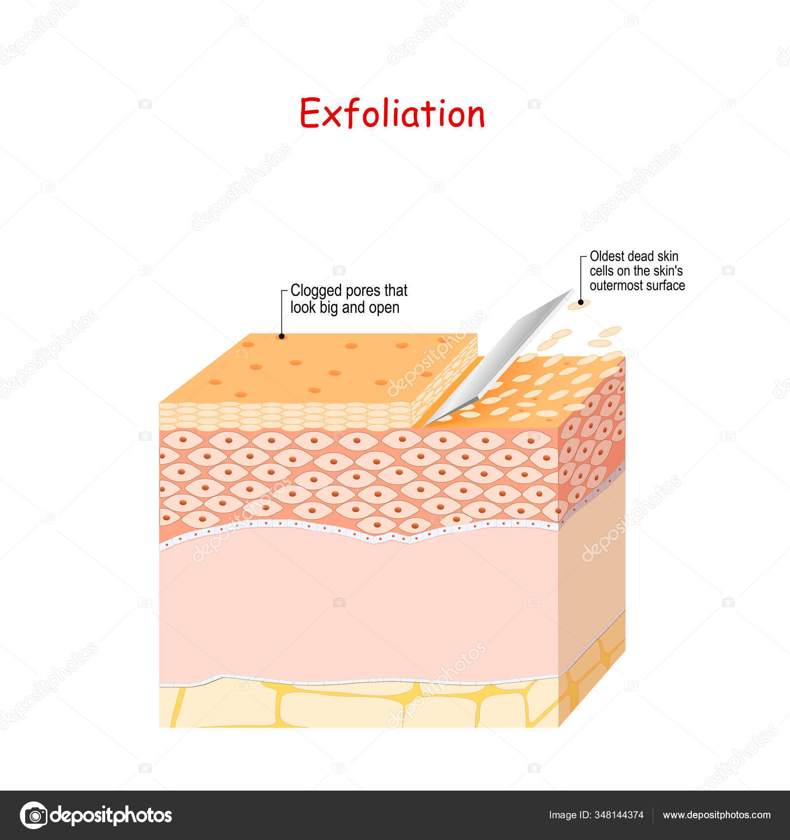 Exfoliation Peeling Physically Scrubbing Skin Care Close Peeling ...