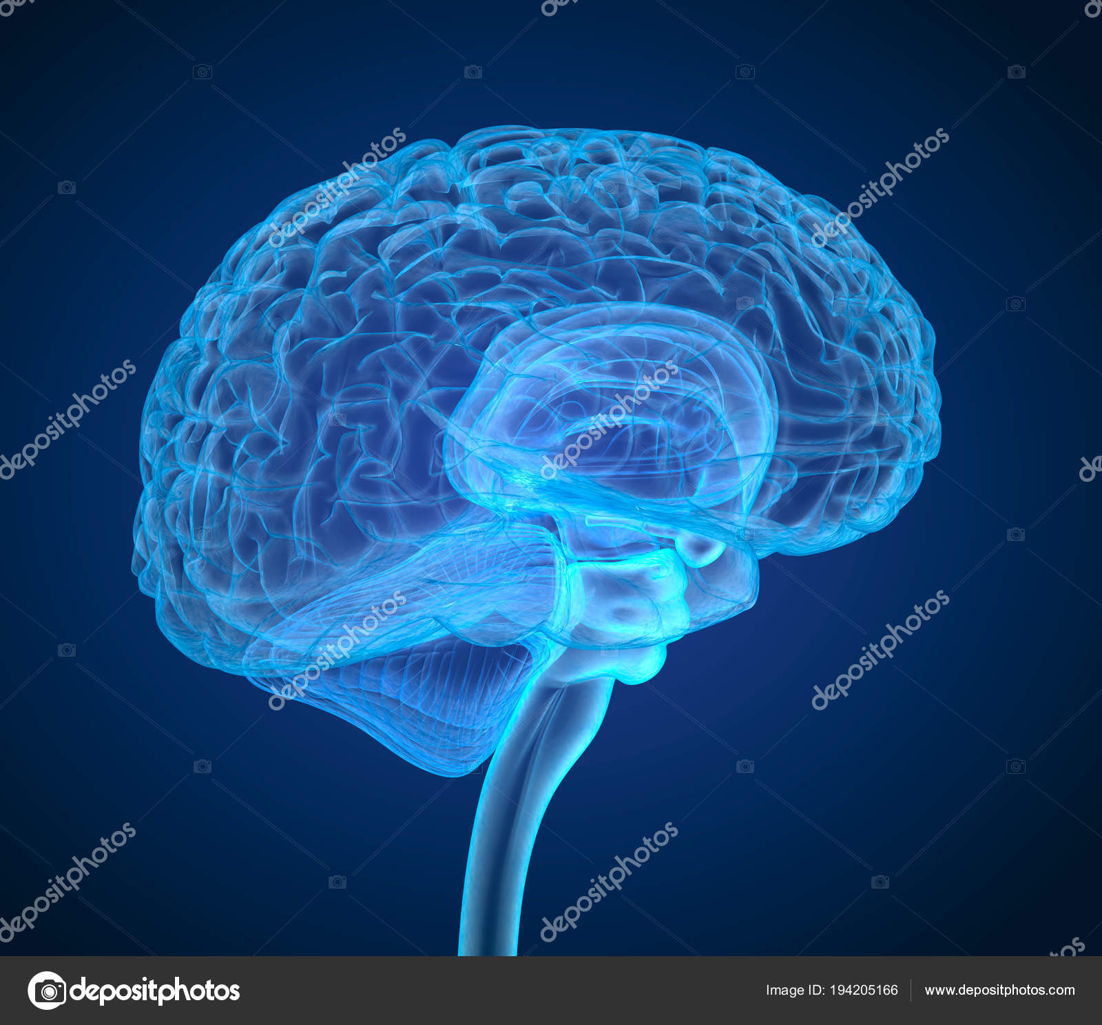 Human Brain Ray Scan Medically Accurate Illustration Stock Photo by ...