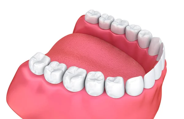 Tanden Stöds Fasta Bron Medicinskt Korrekt Illustration ...