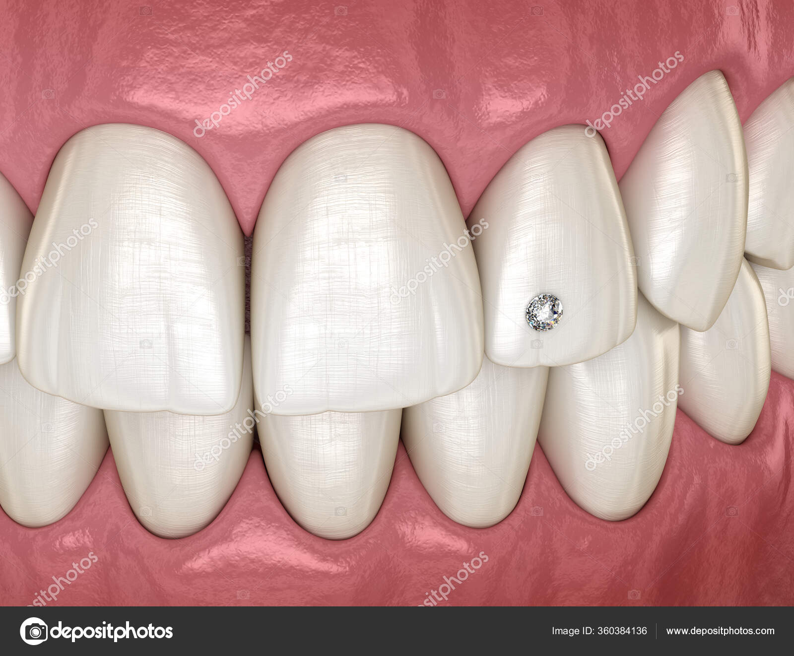 Tooth Piercing Diamond Illustration Concept — Stock Photo © Alexmit ...