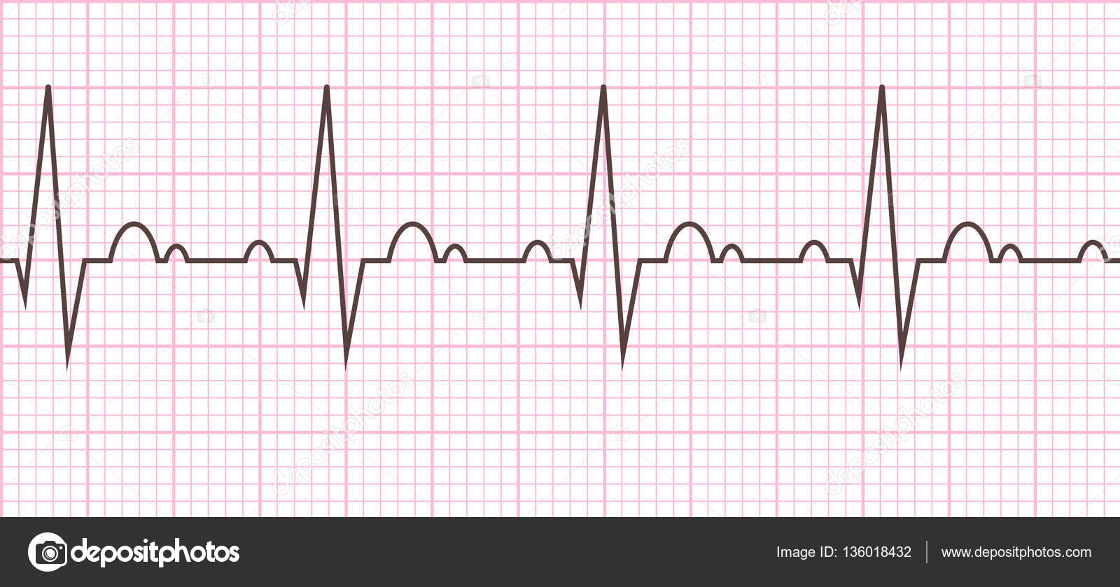 Heart beat. Cardiogram. Cardiac cycle Stock Vector Image by ©kharlamova ...