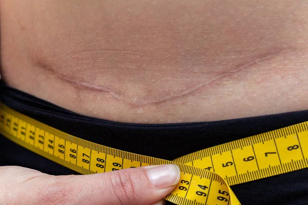 Cesarean section Stock Photos, Royalty Free Cesarean section Images ...