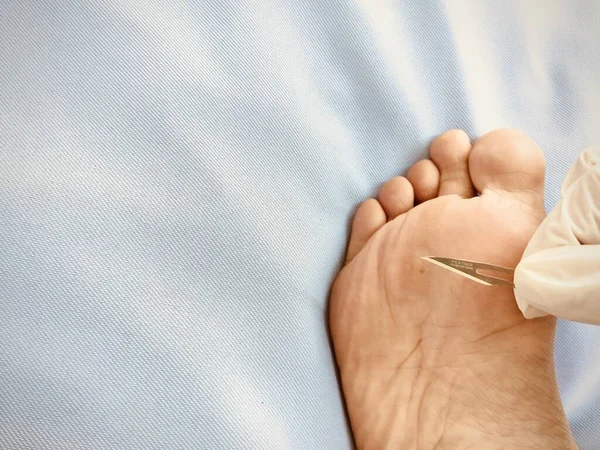 Salicylic acid Stockfoto's, Rechtenvrije Salicylic acid afbeeldingen ...