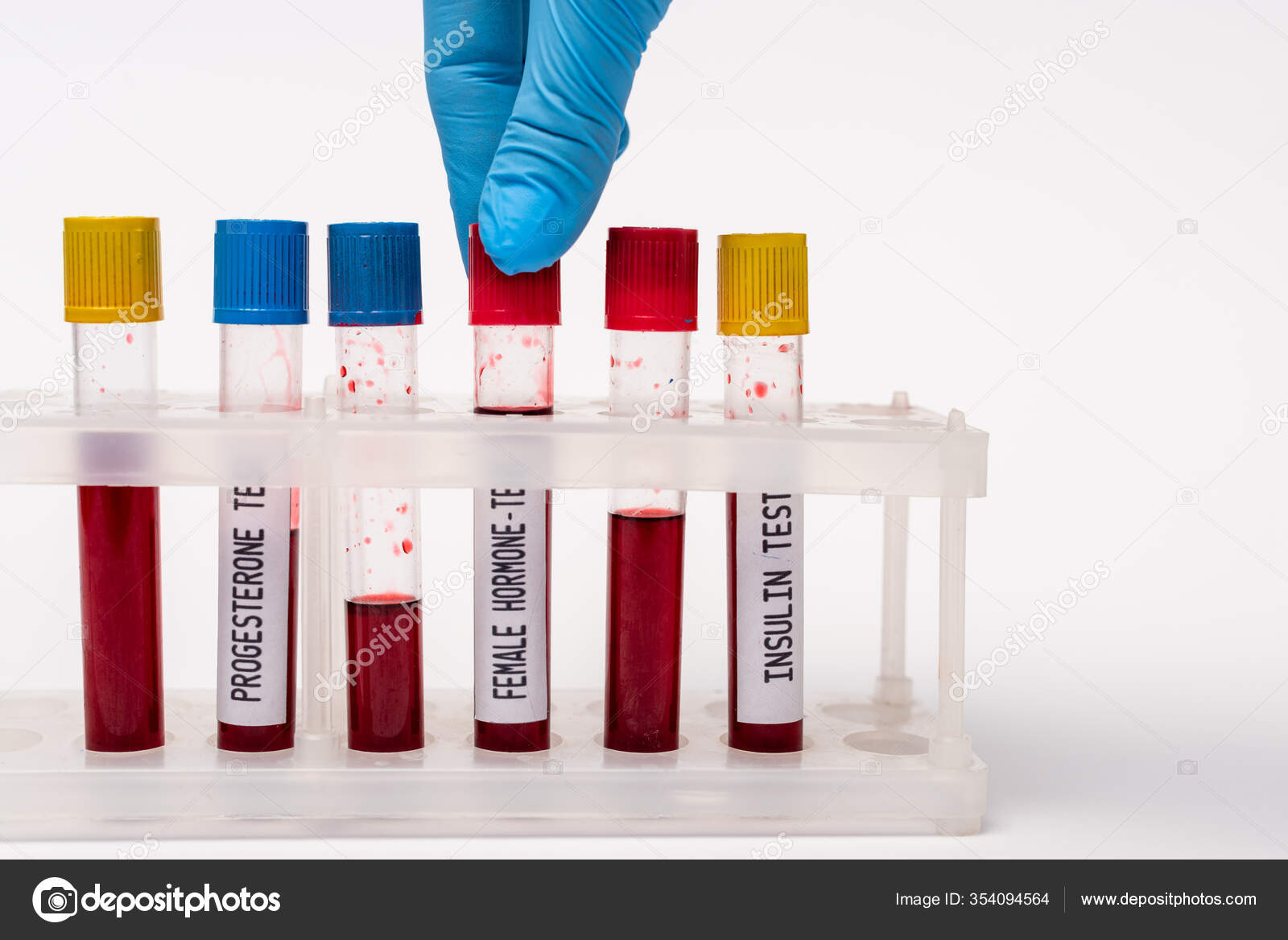 Vista Recortada Del Médico Sosteniendo Muestra Sangre Prueba Hormonal ...