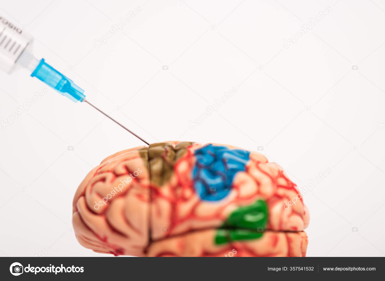 Selective Focus Syringe Brain Model Isolated White Alzheimer Disease ...