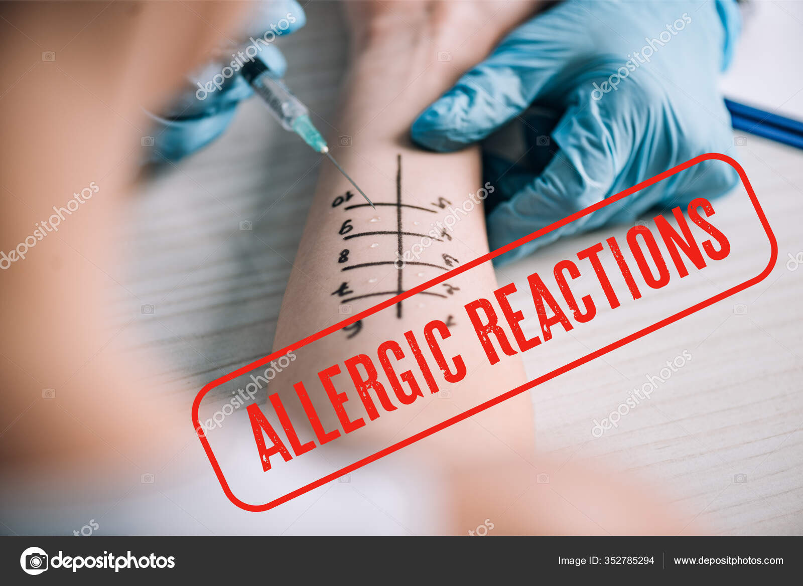 Cropped View Allergist Holding Ruler Marked Hand Woman Allergic ...