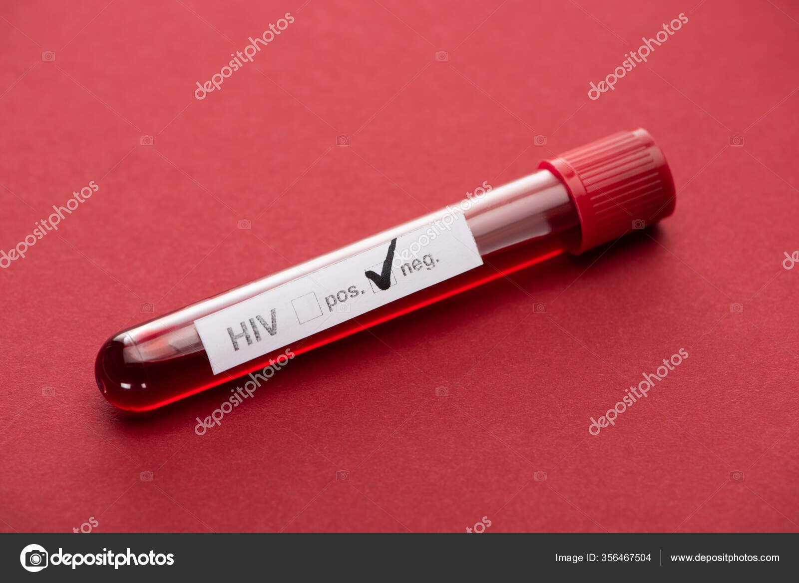 Negative Hiv Blood Sample Test Red Background — Stock Photo ...