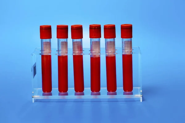 Blood test tubes Stock Photos, Royalty Free Blood test tubes Images ...