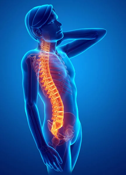 Male Hurt Backbone - Vertebrae Pain — Stock Photo © decade3d #22972110
