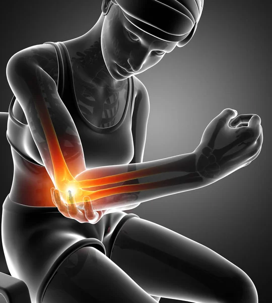 Feeling Elbow pain - Stock Image - Everypixel