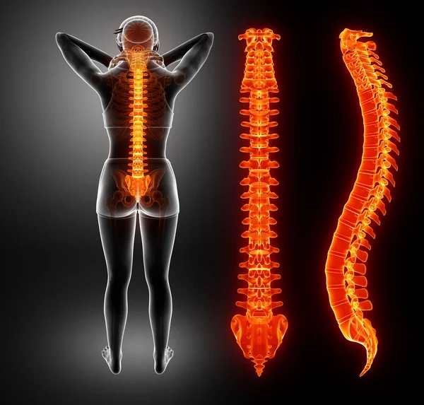 Women Feeling the Back pain - Stock Image - Everypixel