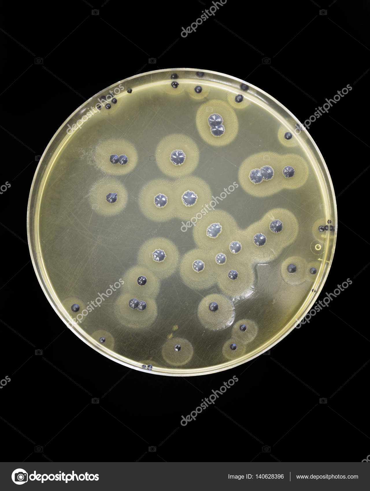 Staphylococcus aureus growing on Baird Parker — Stock Photo © ggw1962 ...