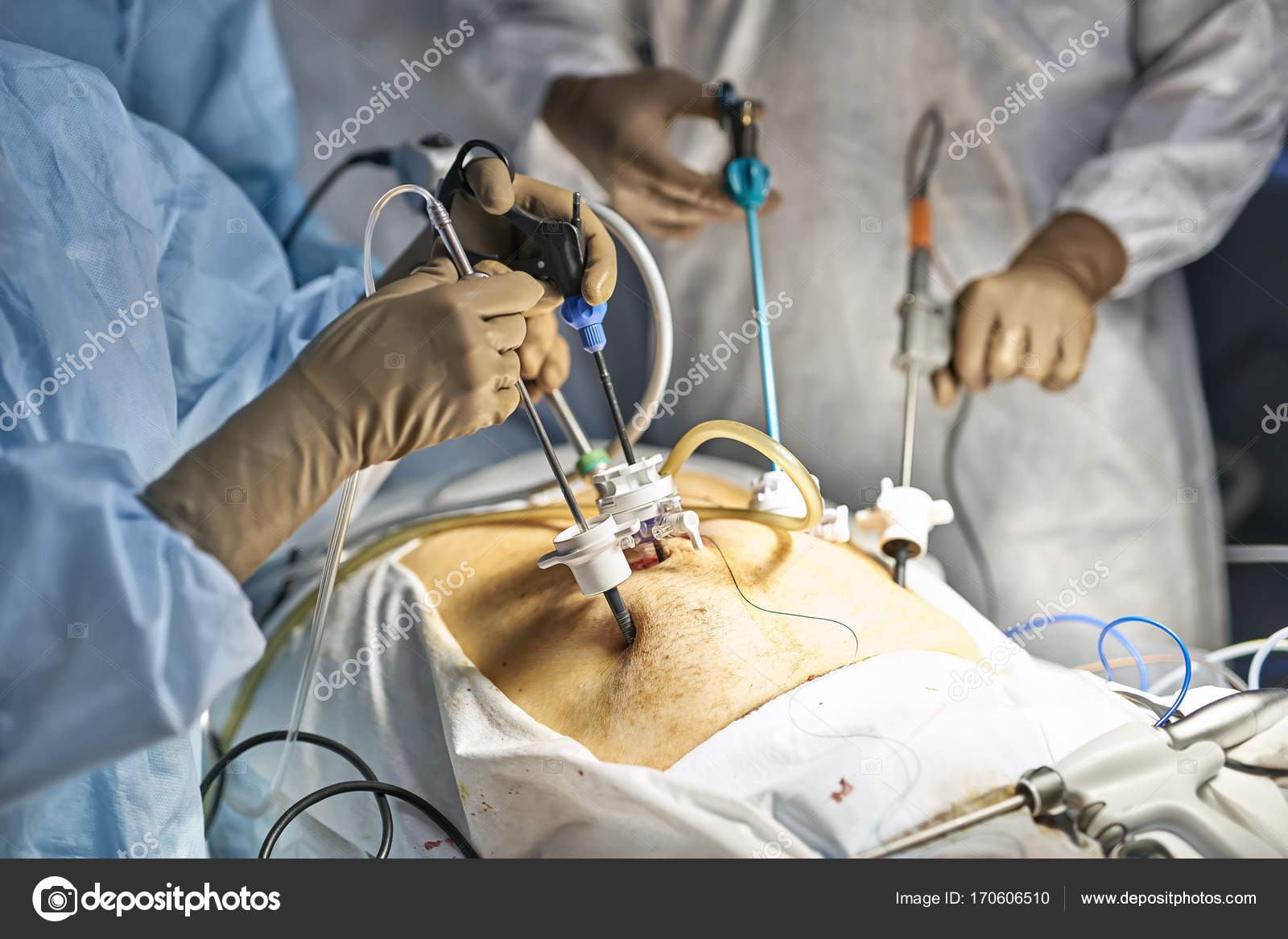 Laparoscopy operation process Stock Photo by ©bezikus 170606510