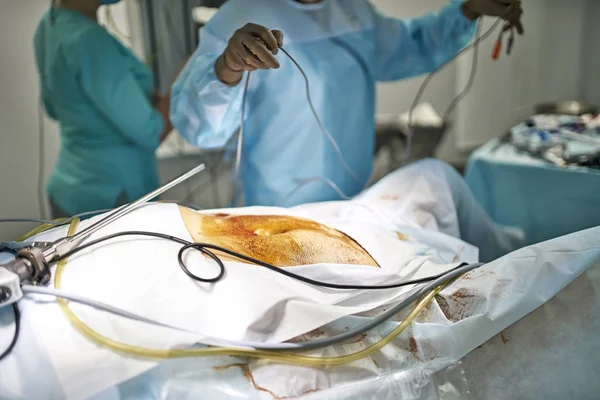 Laparoscopy operation process Stock Photo by ©bezikus 170606510