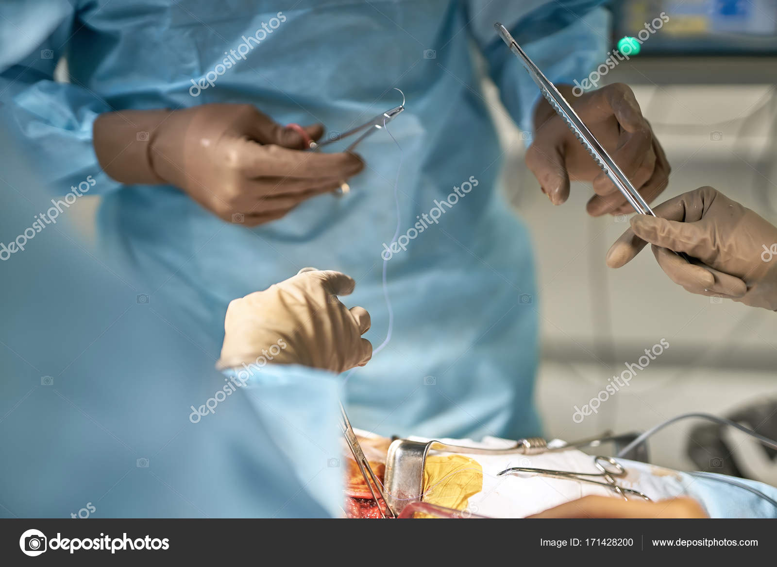 Abdominal operation process Stock Photo by ©bezikus 171428200