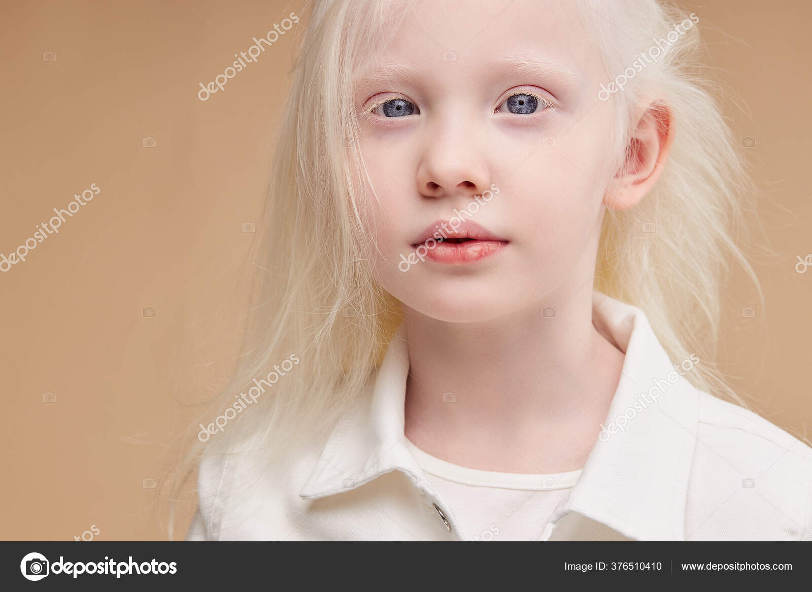 Young People With Natural White Hair